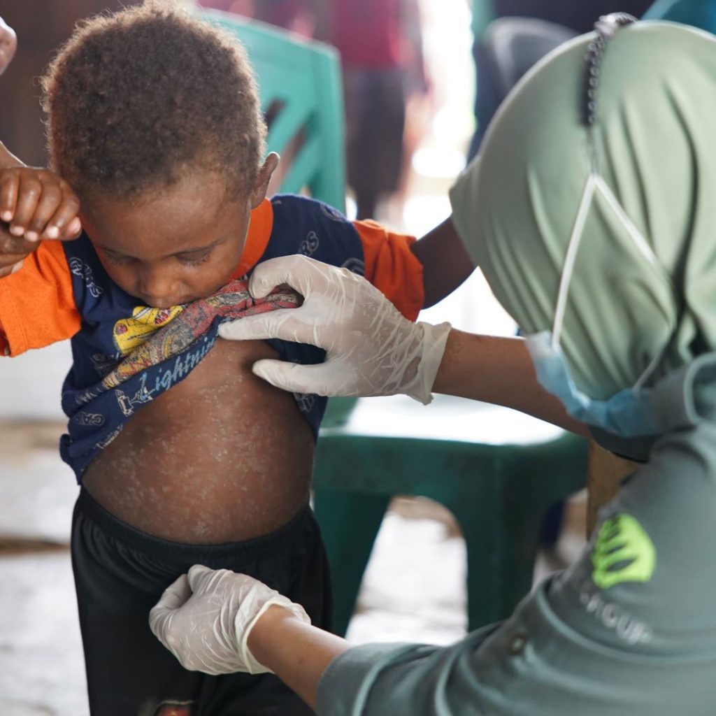 Uncovering Stories of Inner Papua through Free Medical Services – TSE GROUP